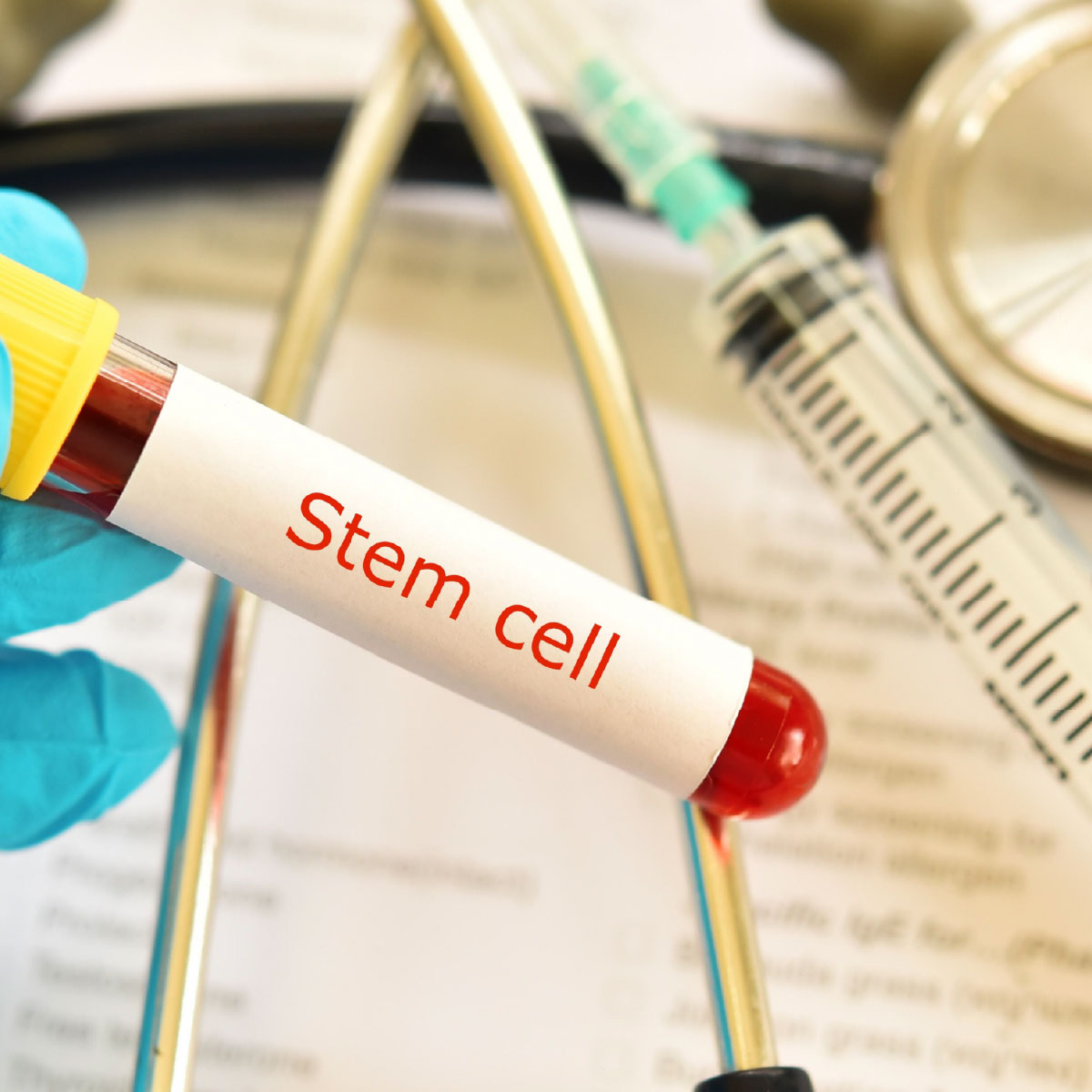 Stem Cell Collection at Birth: Step-by-Step Process