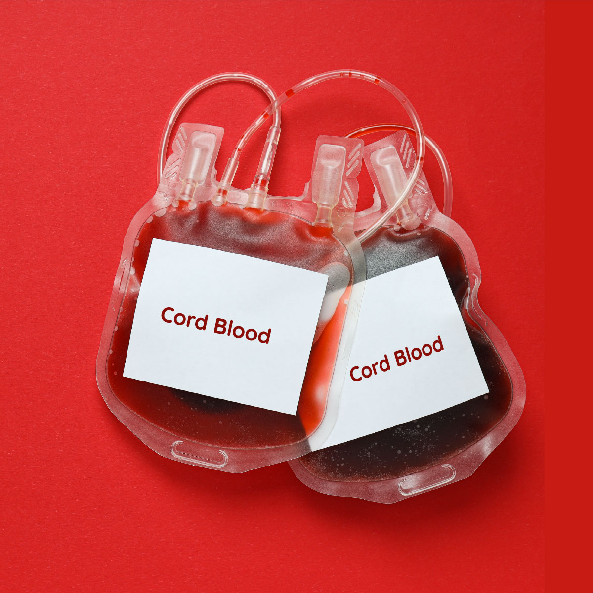 The Power of Umbilical Cord Blood Banking for Future Health