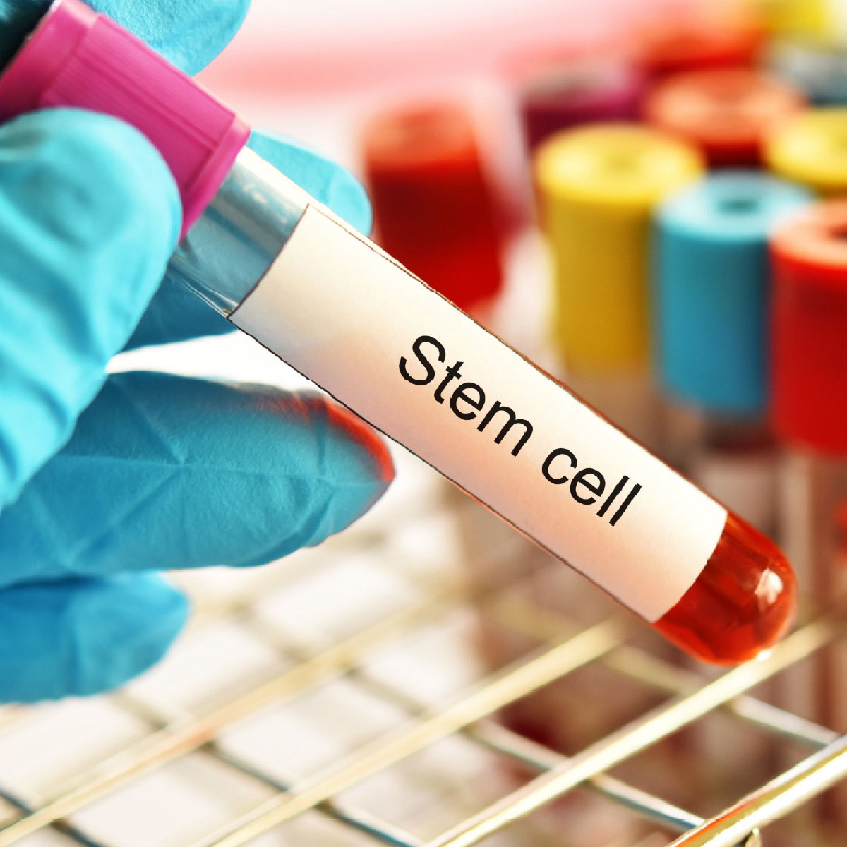 Stem Cell Banking Service at Affordable Cost