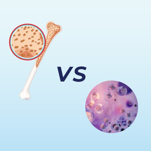 Difference Between Bone Marrow and Cord Blood Stem Cells