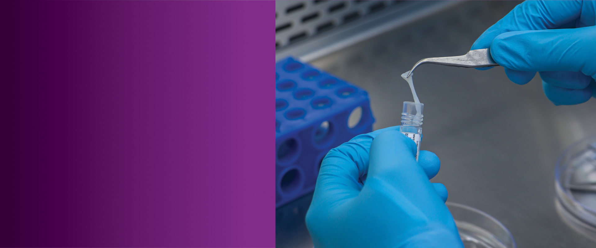 Umbilical Cord Lining & Cord Tissue Preservation